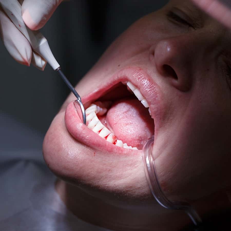 Amlodipine (Norvasc) Side Effects | The People's Pharmacy